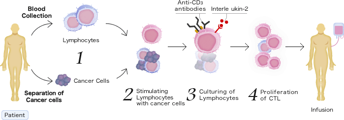 Types of Immuno-Cell Therapy｜Seta Clinic Group